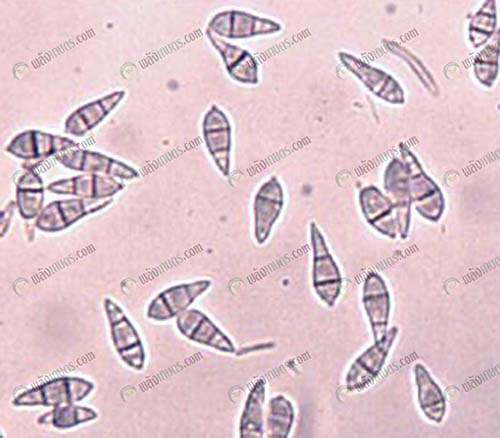 การป้องกันกำจัดโรคข้าวที่เกิดจากเชื้อรา-Pyricularia-grisea-Sacc. - พลัง ...